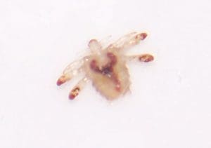 Pubic Crab Lice Treatment & Control | Terminix Pest Experts